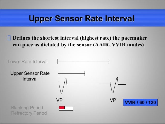 Pacemaker basics