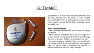 Pacemaker – Device Regulations in India and other Countries .pptx