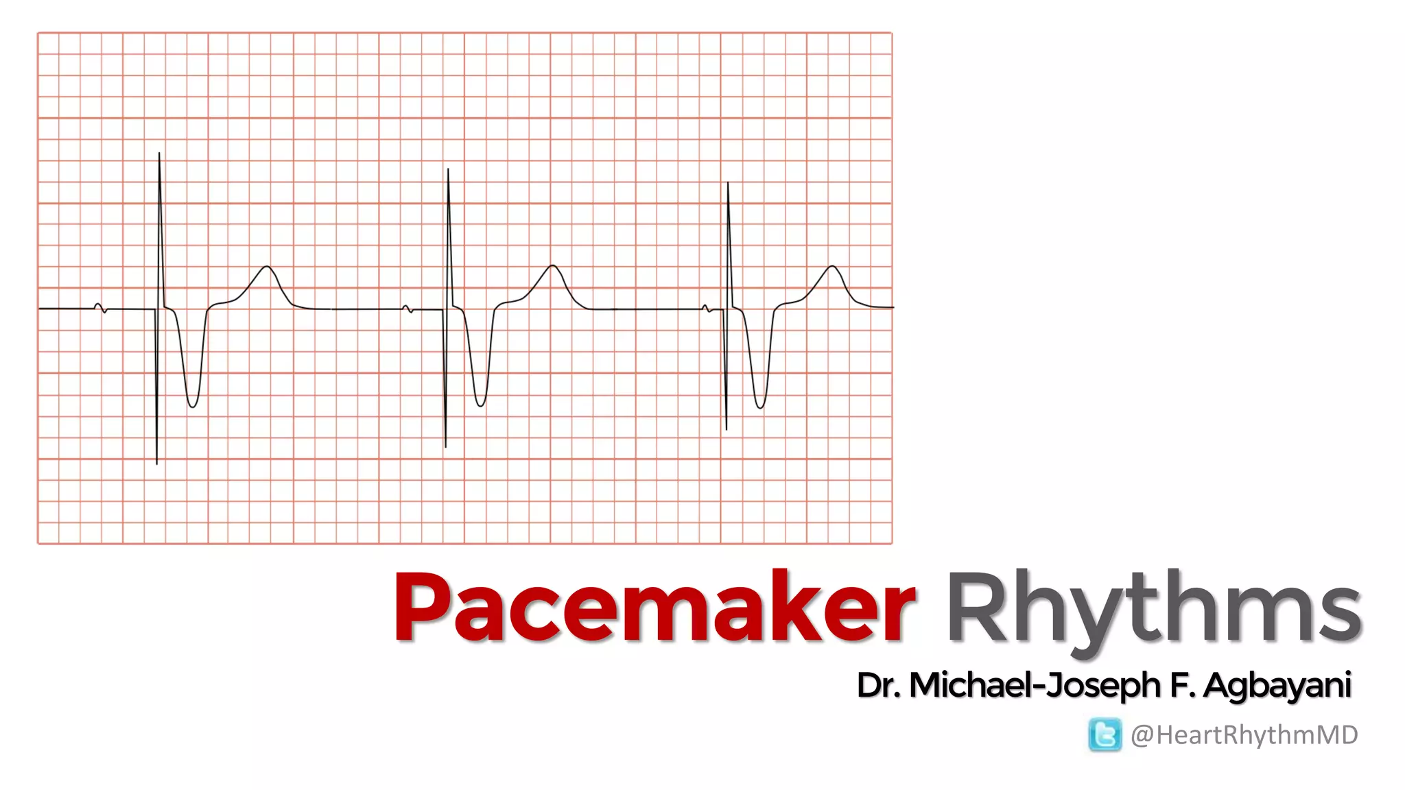 Pacemaker Rhythms | PDF