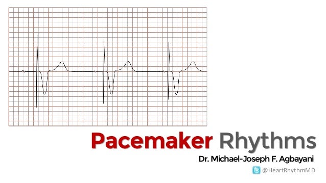 Pacemaker Rhythms