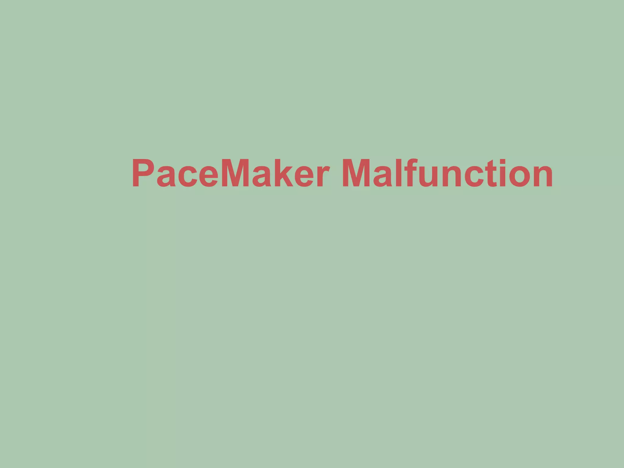 Pacemaker ECGs. Yasmeen Kamal | PPTX