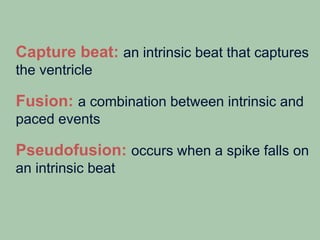 Pacemaker ECGs. Yasmeen Kamal | PPTX