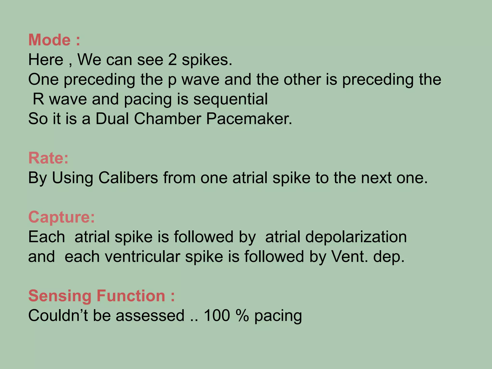 Pacemaker ECGs. Yasmeen Kamal | PPTX