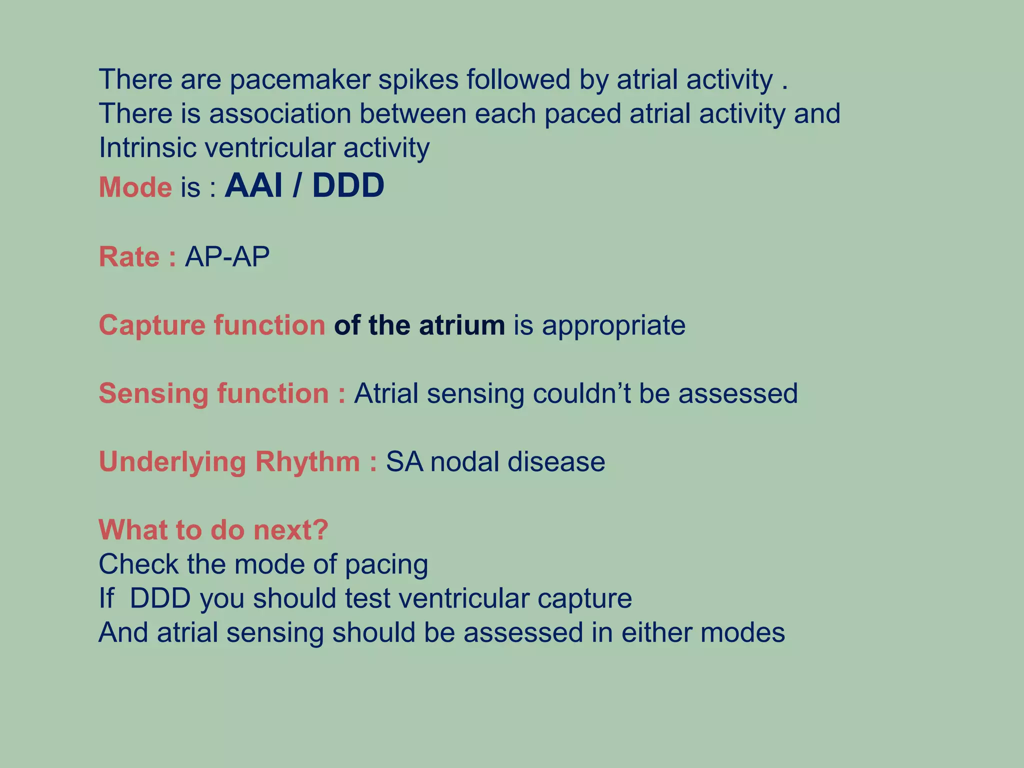 Pacemaker ECGs. Yasmeen Kamal | PPTX