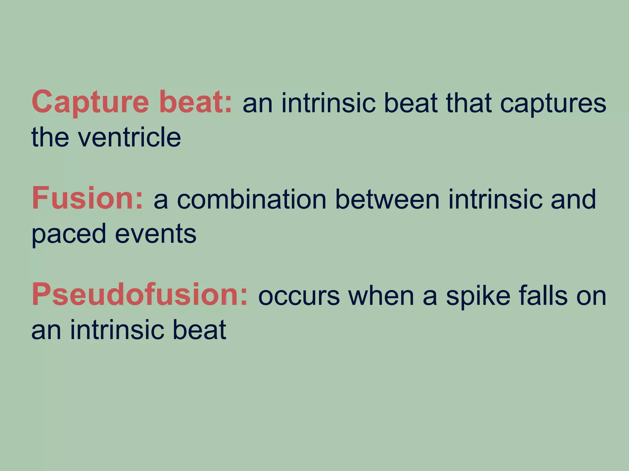 Pacemaker ECGs. Yasmeen Kamal | PPTX