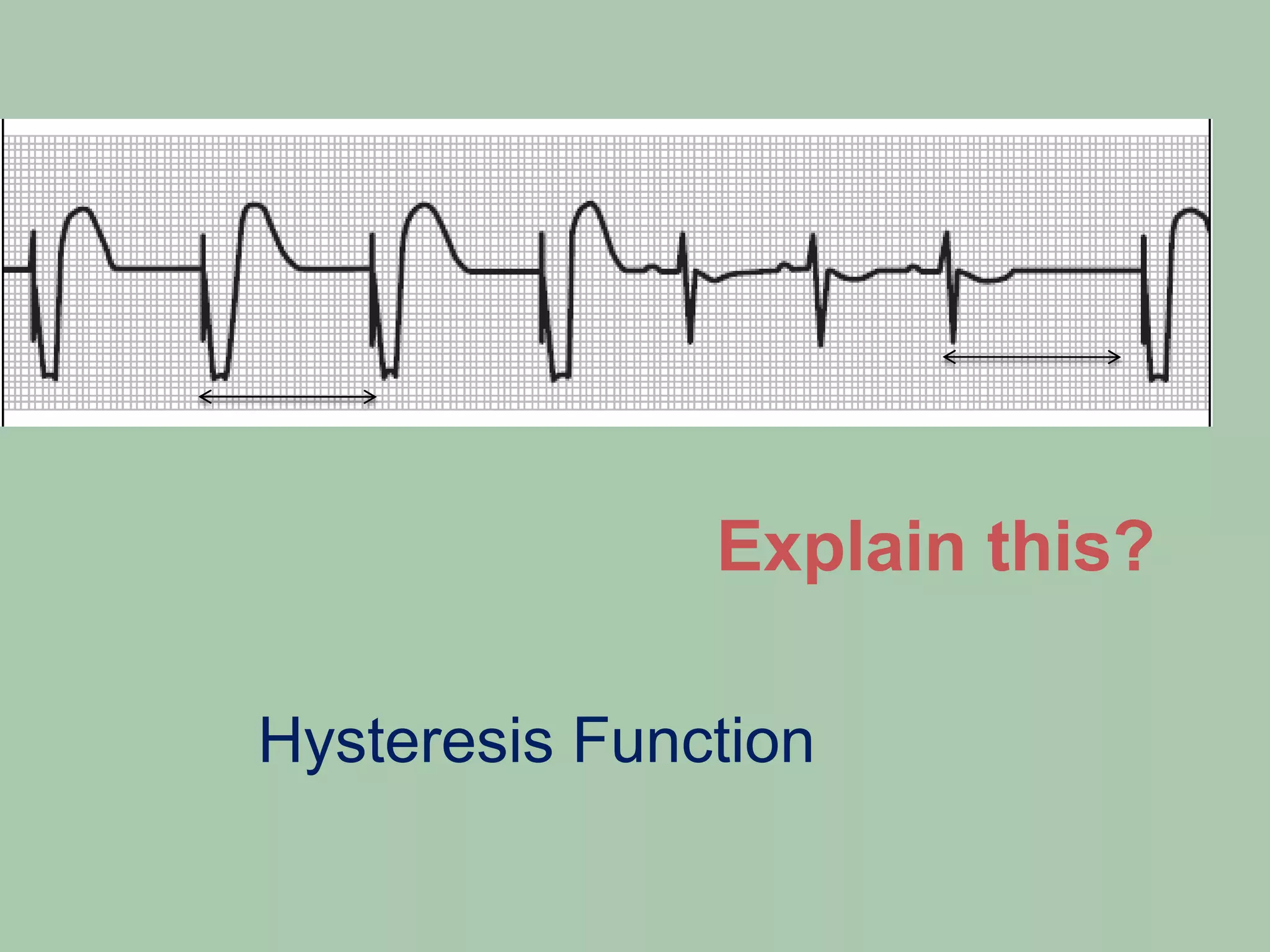 Pacemaker ECGs. Yasmeen Kamal | PPTX