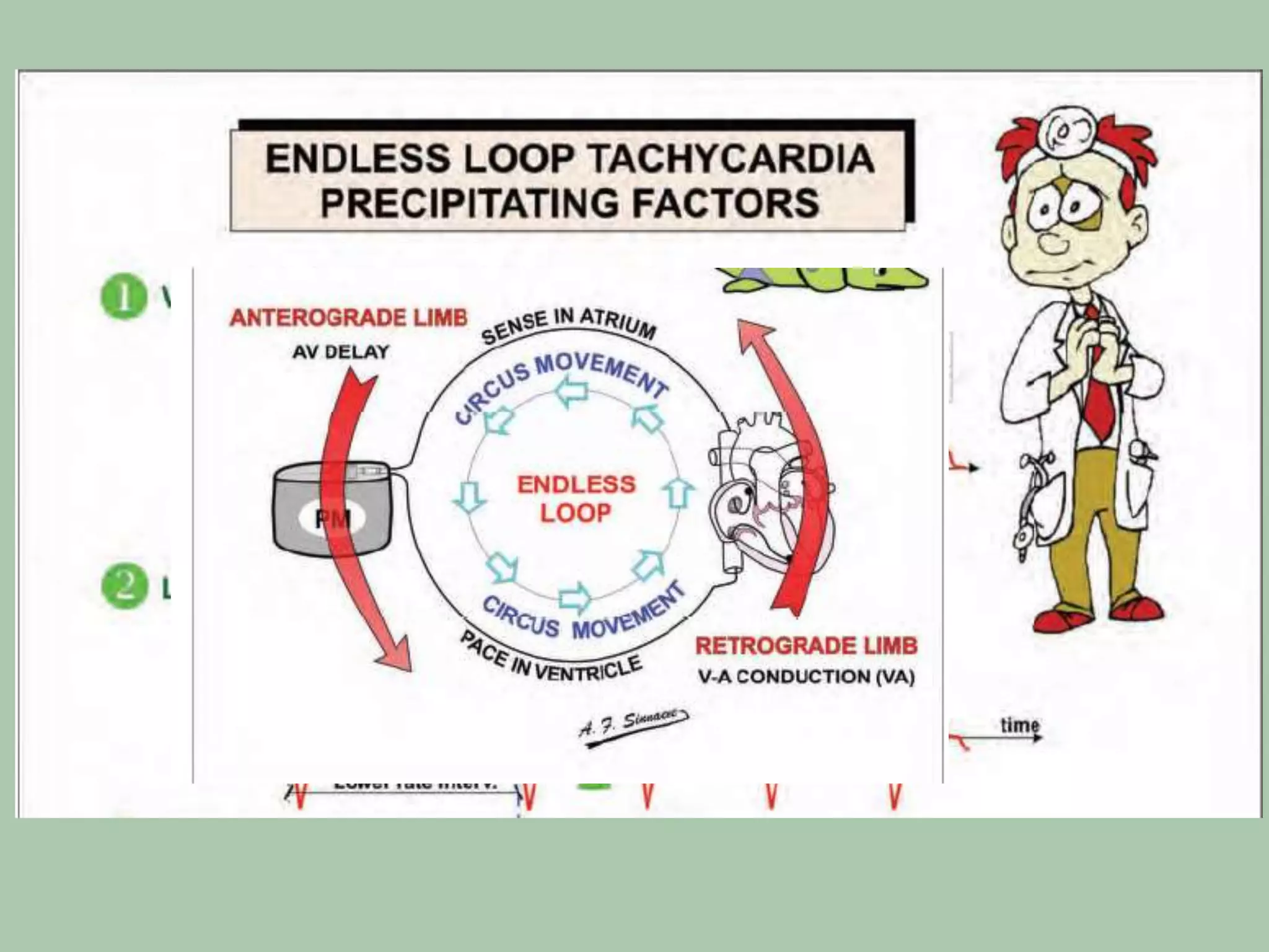 Pacemaker ECGs. Yasmeen Kamal | PPTX