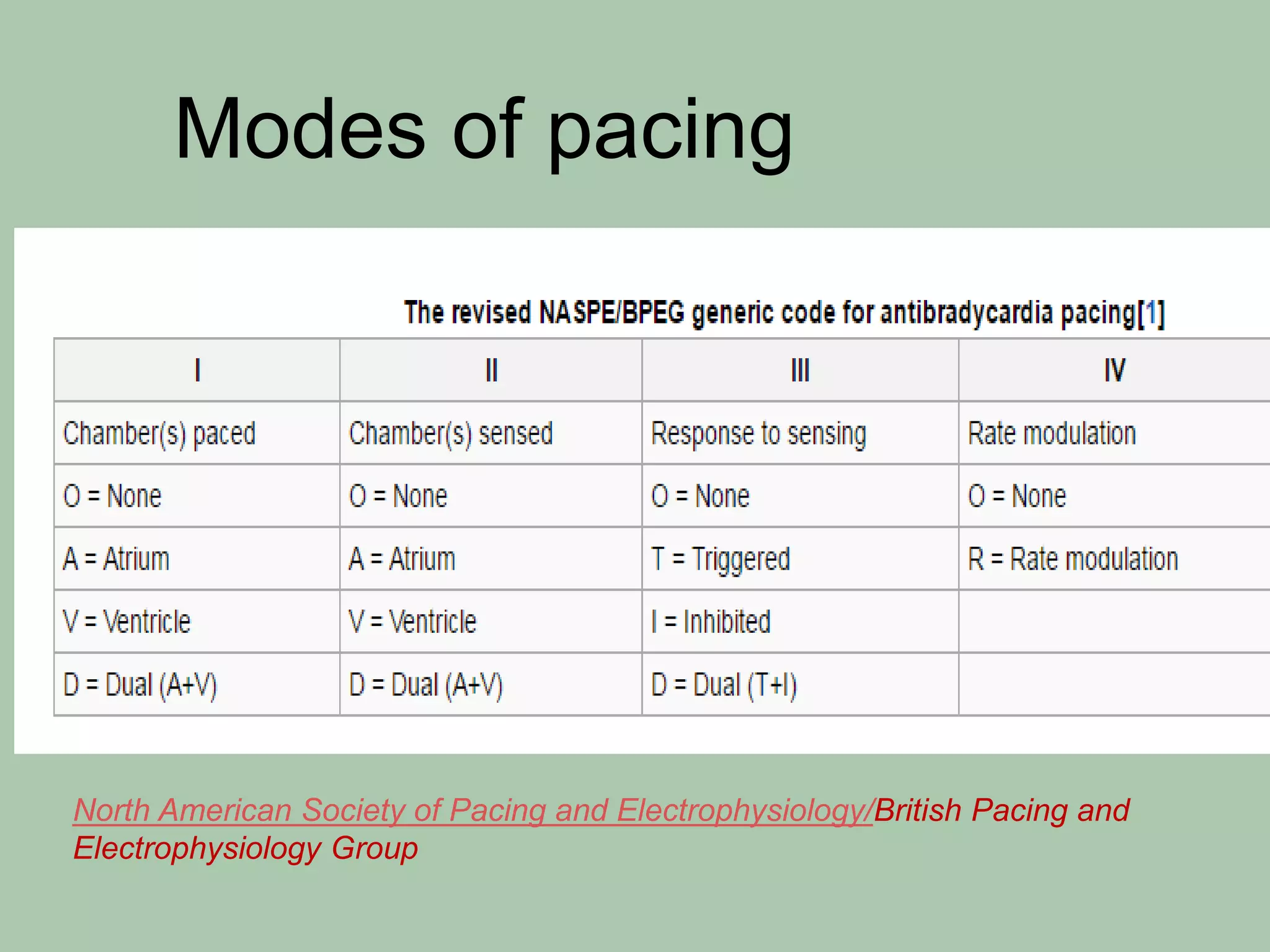 Pacemaker ECGs. Yasmeen Kamal | PPTX