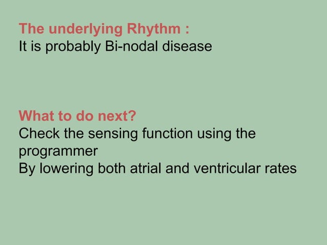 Pacemaker ECGs. Yasmeen Kamal | PPTX