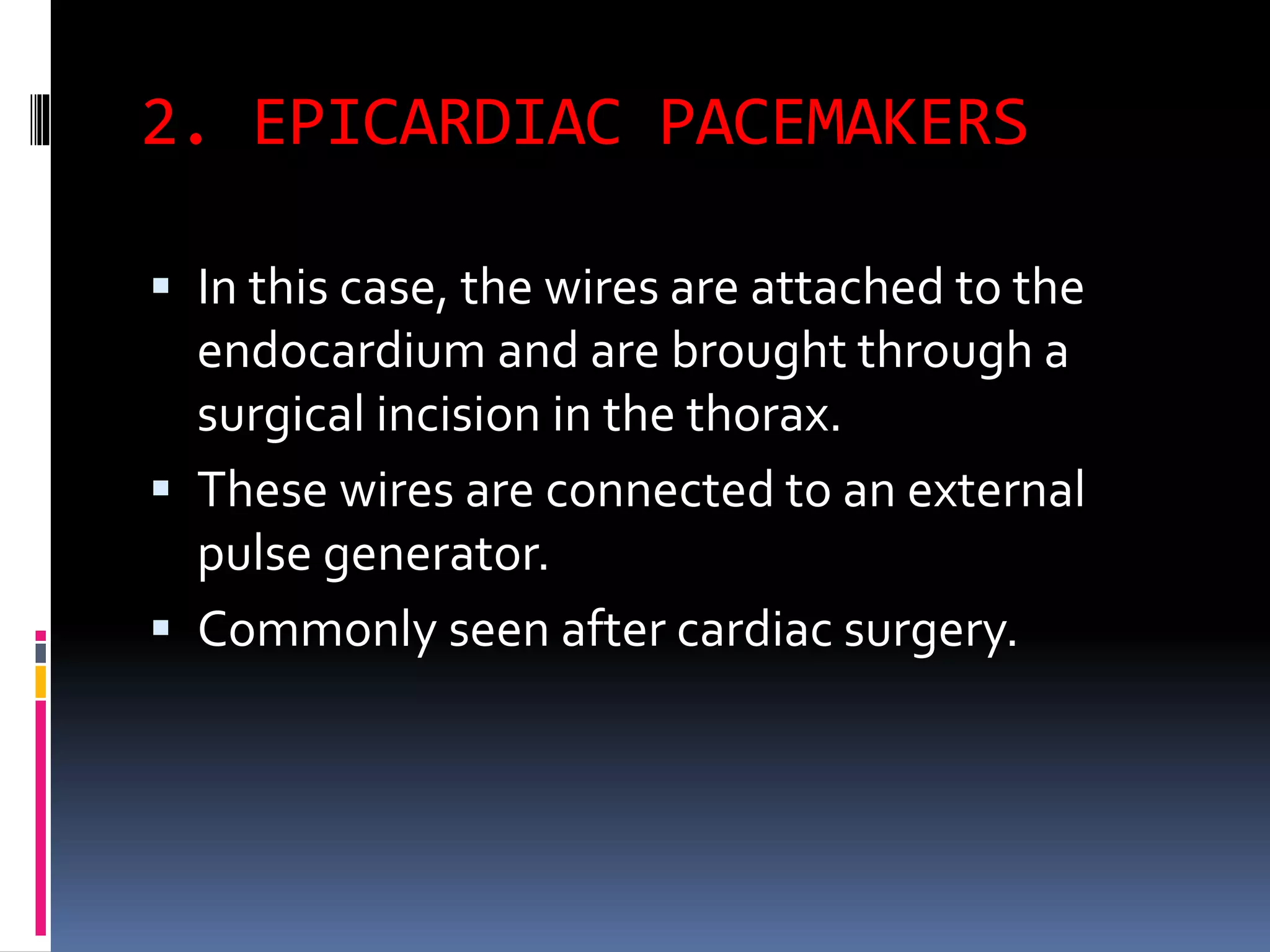 Pacemaker powerpoint presentation med surg | PPTX