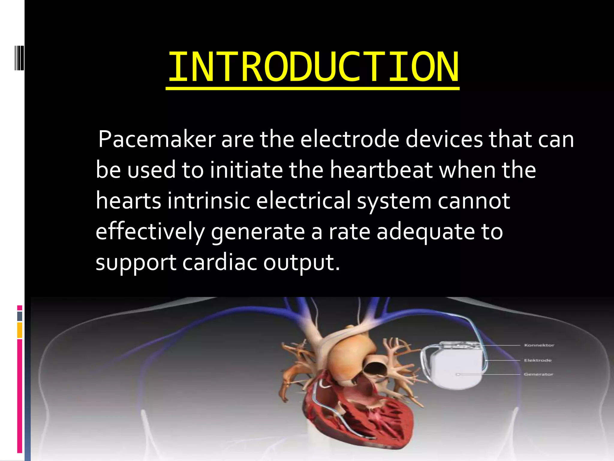 Pacemaker powerpoint presentation med surg | PPTX