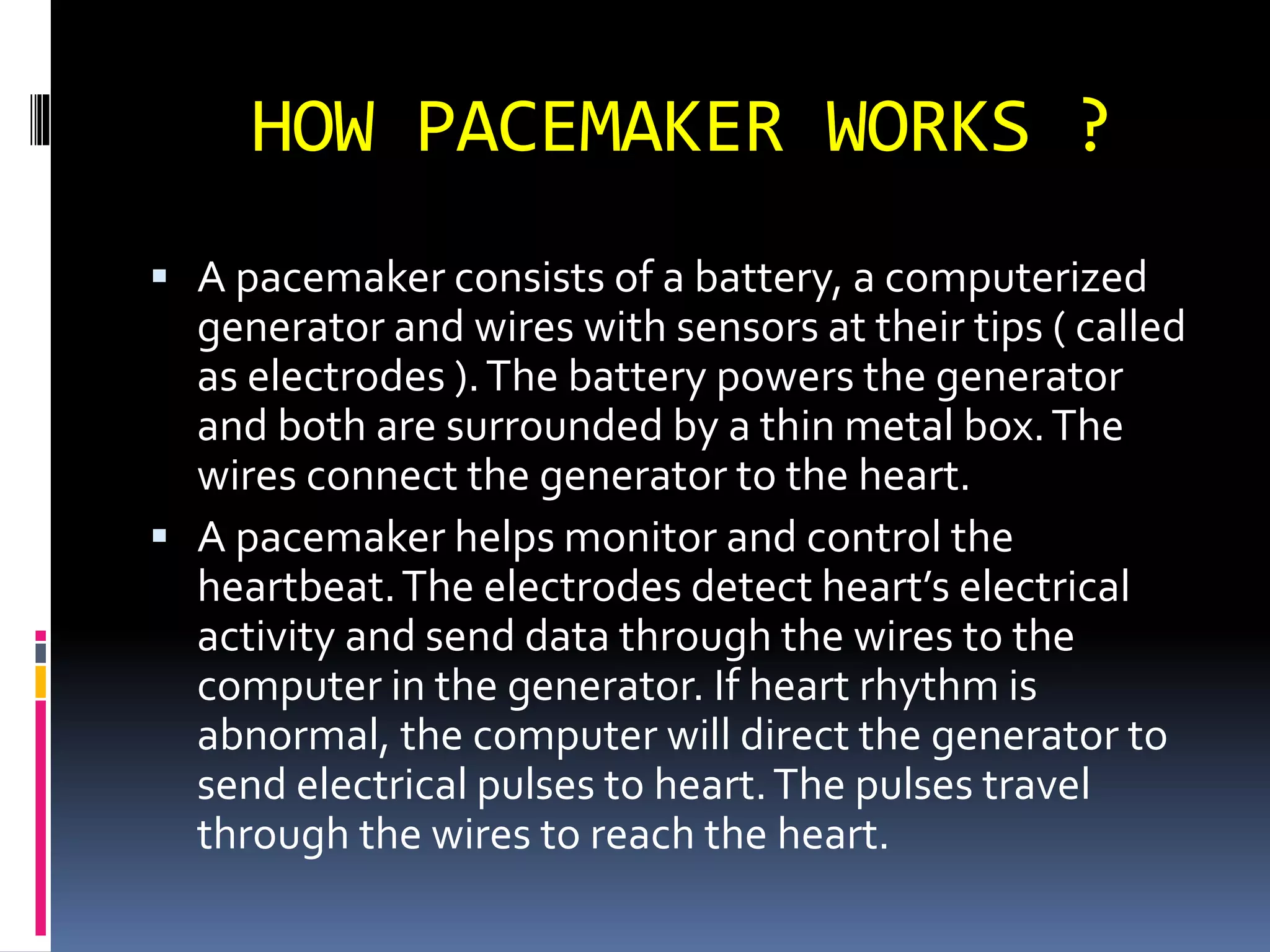 Pacemaker powerpoint presentation med surg | PPTX