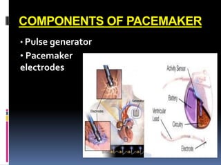 Pacemaker powerpoint presentation med surg | PPTX