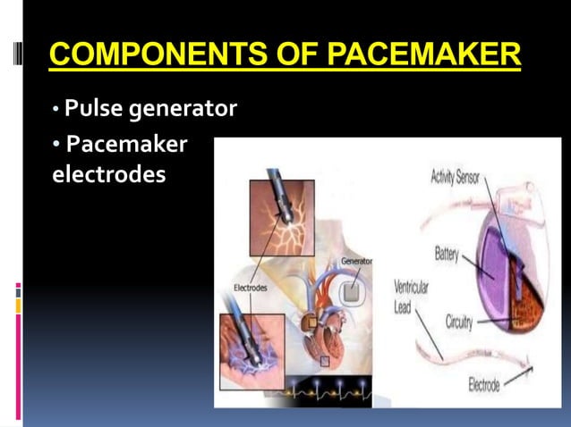 Pacemaker powerpoint presentation med surg | PPTX | Heart and ...
