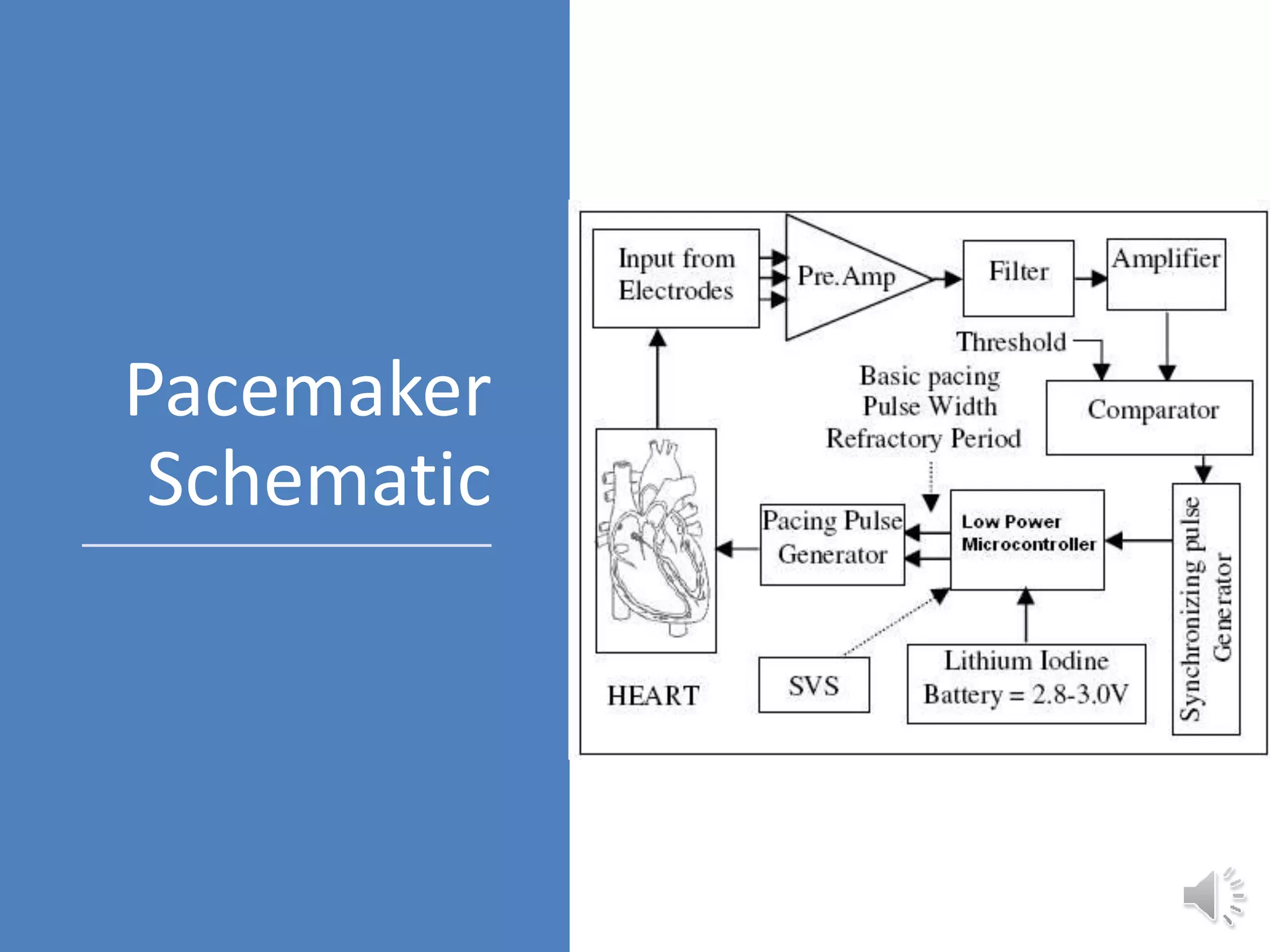 Pacemaker | PPTX