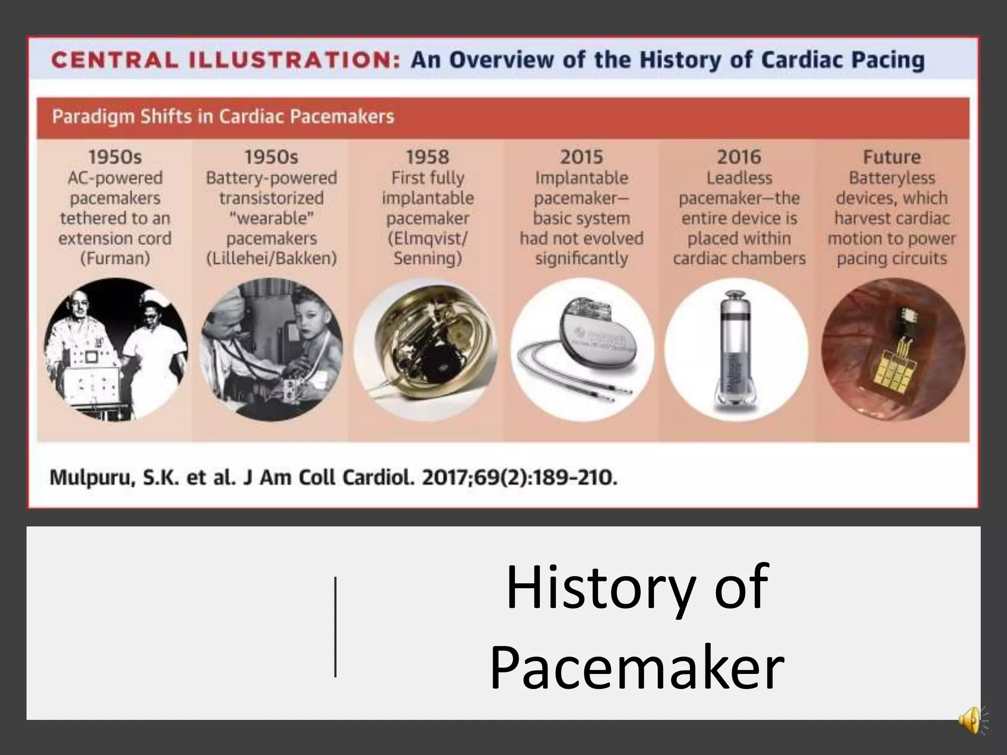 Pacemaker | PPTX
