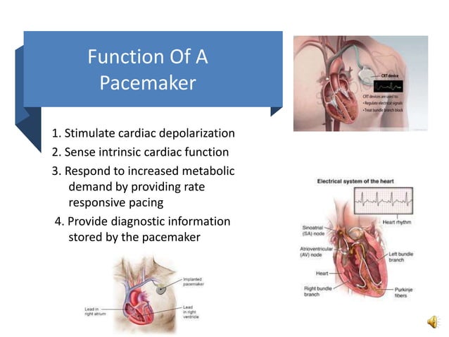 Pacemaker | PPTX | Heart and Cardiovascular Diseases | Diseases and ...