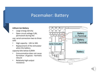 Pacemaker | PPTX