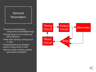 Pacemaker | PPTX