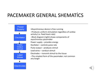 Pacemaker | PPTX