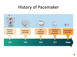 Pacemaker | PPT