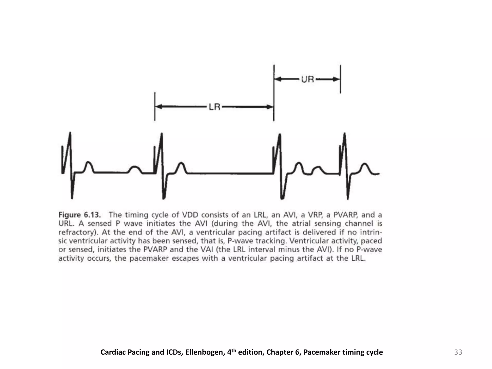 Evaluation and management of Pacemaker malfunction | PPTX