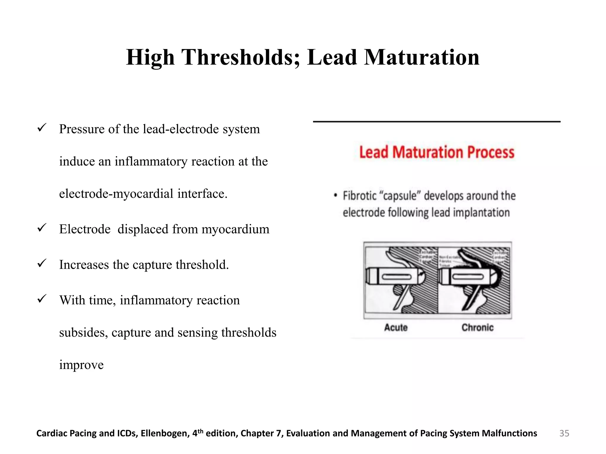 Evaluation and management of Pacemaker malfunction | PPTX