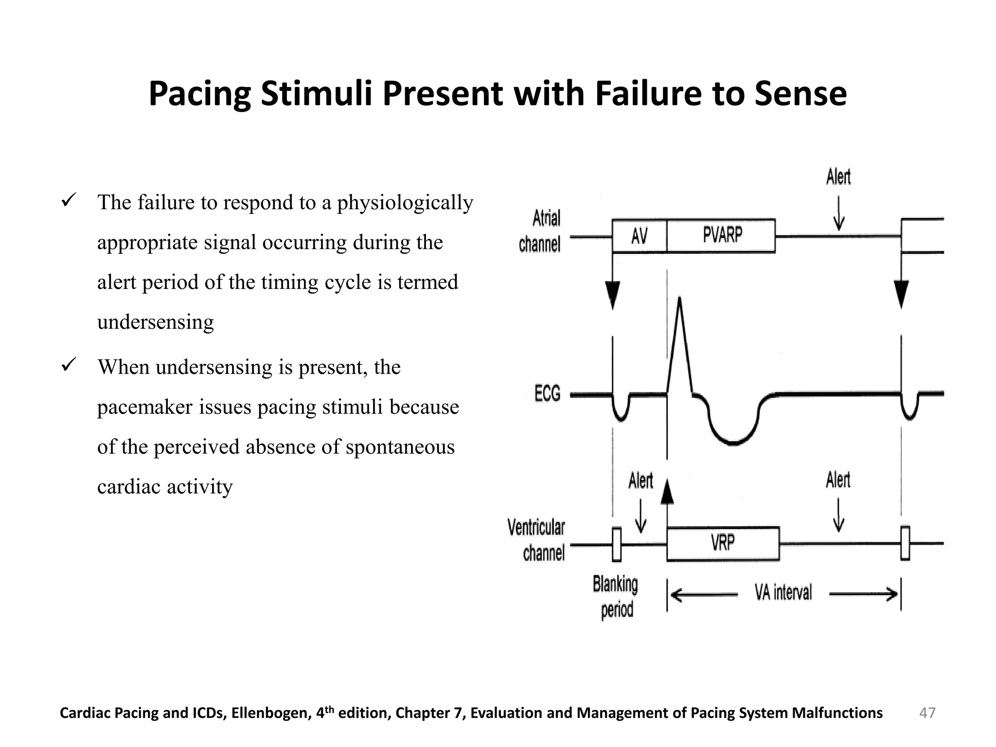 Evaluation and management of Pacemaker malfunction | PPTX