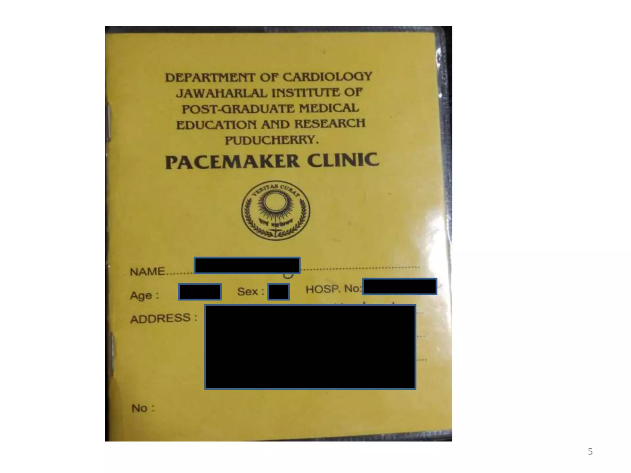 Evaluation and management of Pacemaker malfunction | PPTX