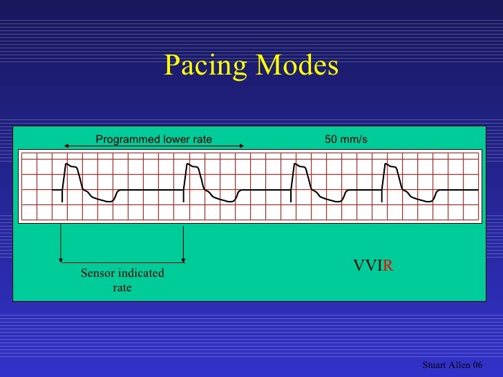 Pacemaker Overview
