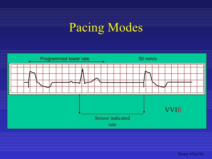 Pacemaker Overview