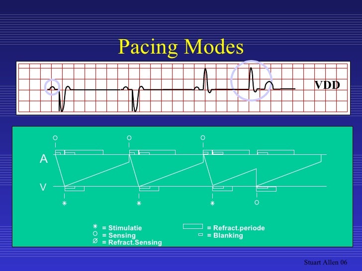 Pacemaker Overview