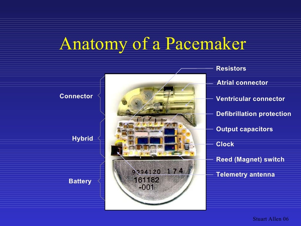 Pacemaker Overview