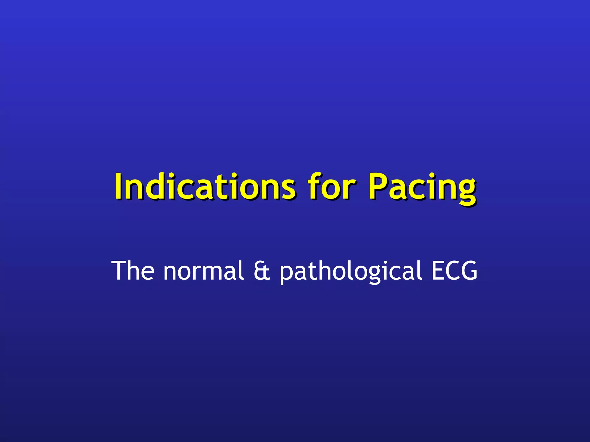 Pacemaker overview | PPT