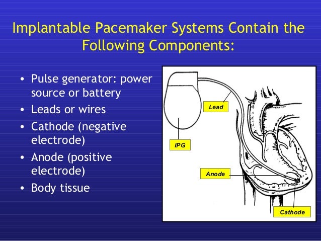 Pacemaker overview