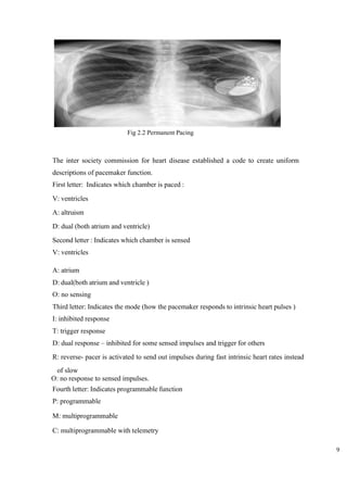 pacemaker perfect (1) (1).pdf