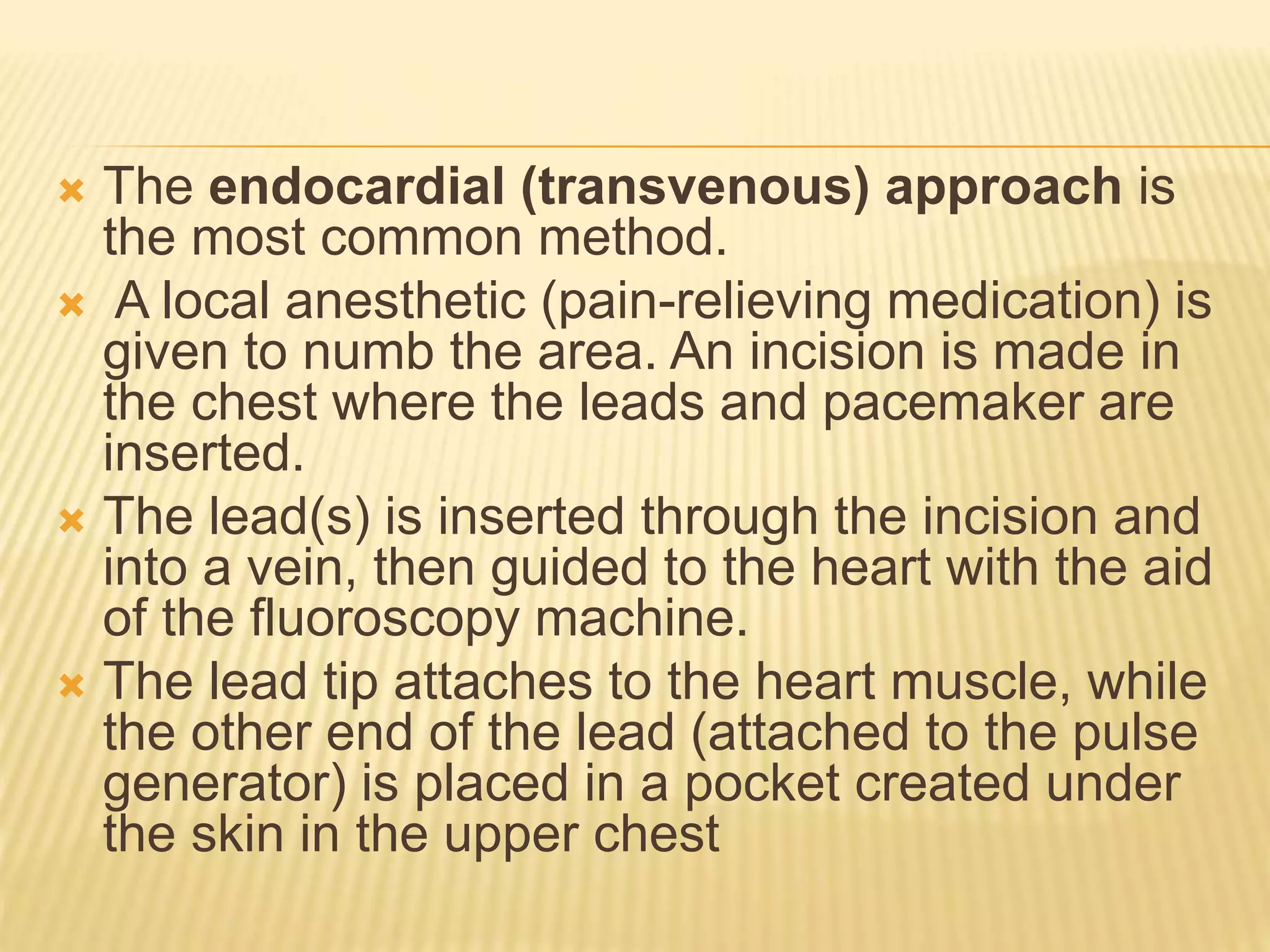 Pacemaker Implant | PPTX