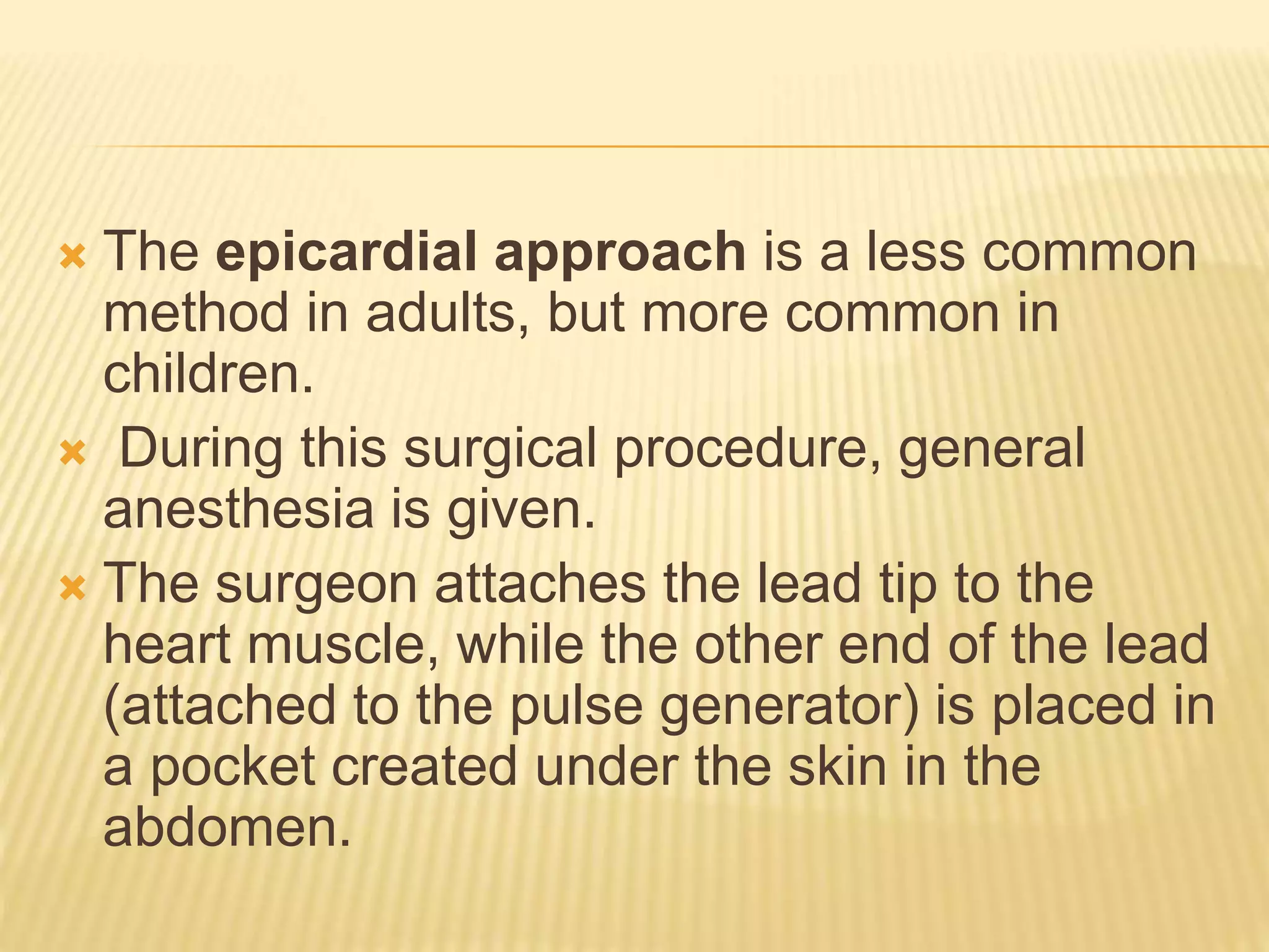 Pacemaker Implant | PPTX