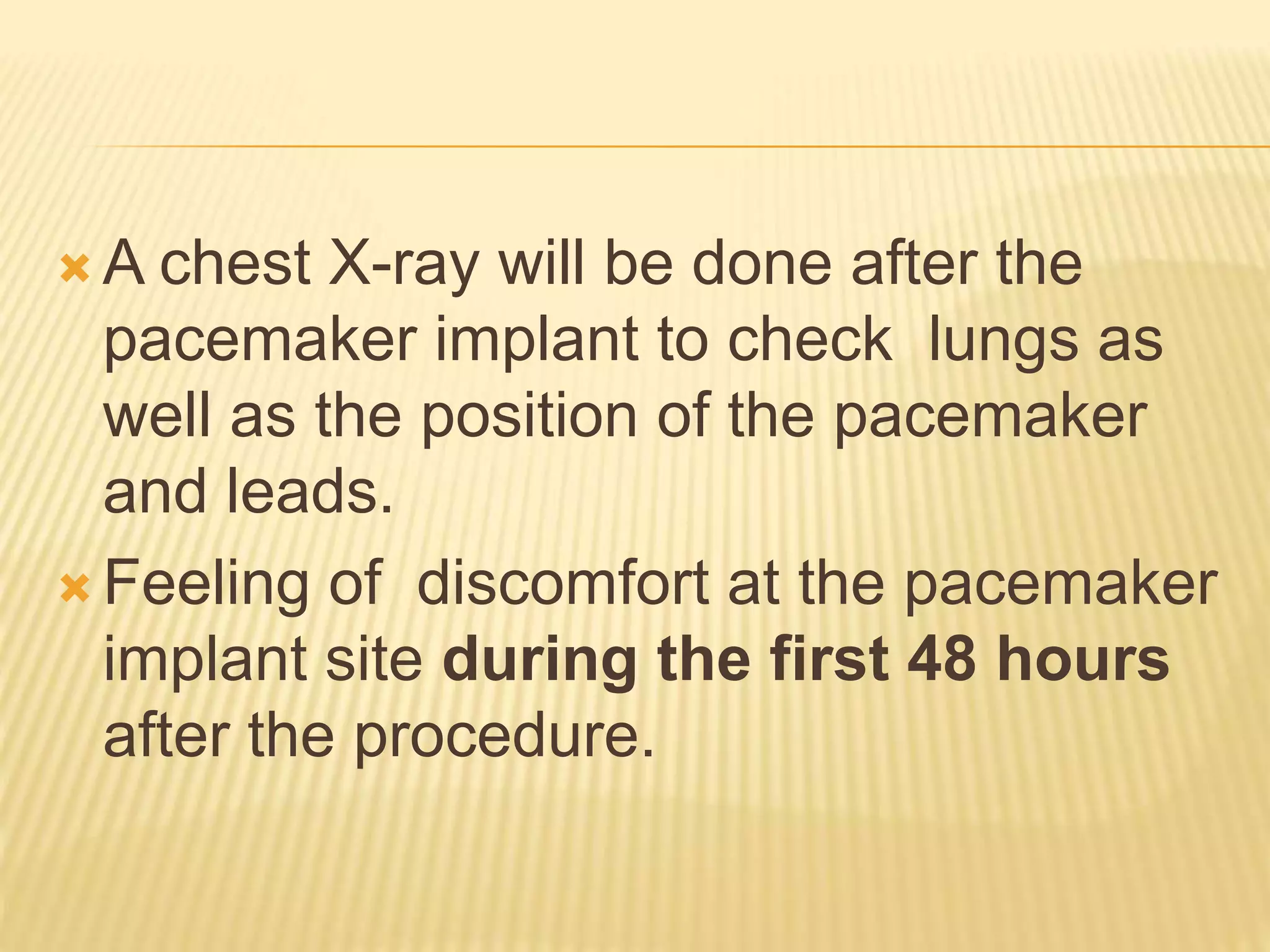 Pacemaker Implant | PPTX