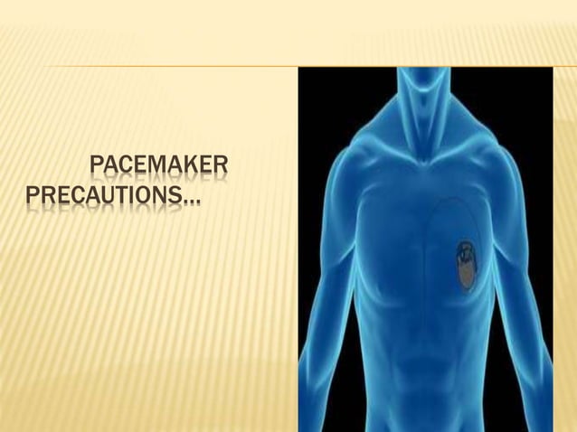 Pacemaker Implant | PPTX | Heart and Cardiovascular Diseases | Diseases ...
