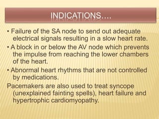 Pacemaker Implant | PPTX
