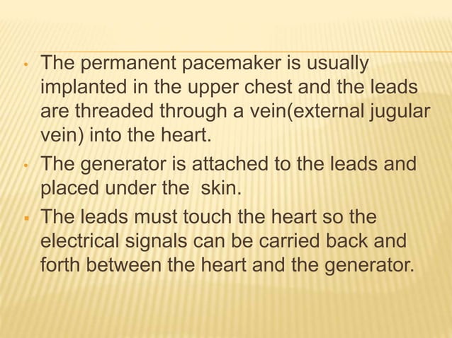 Pacemaker Implant | PPTX | Heart and Cardiovascular Diseases | Diseases ...