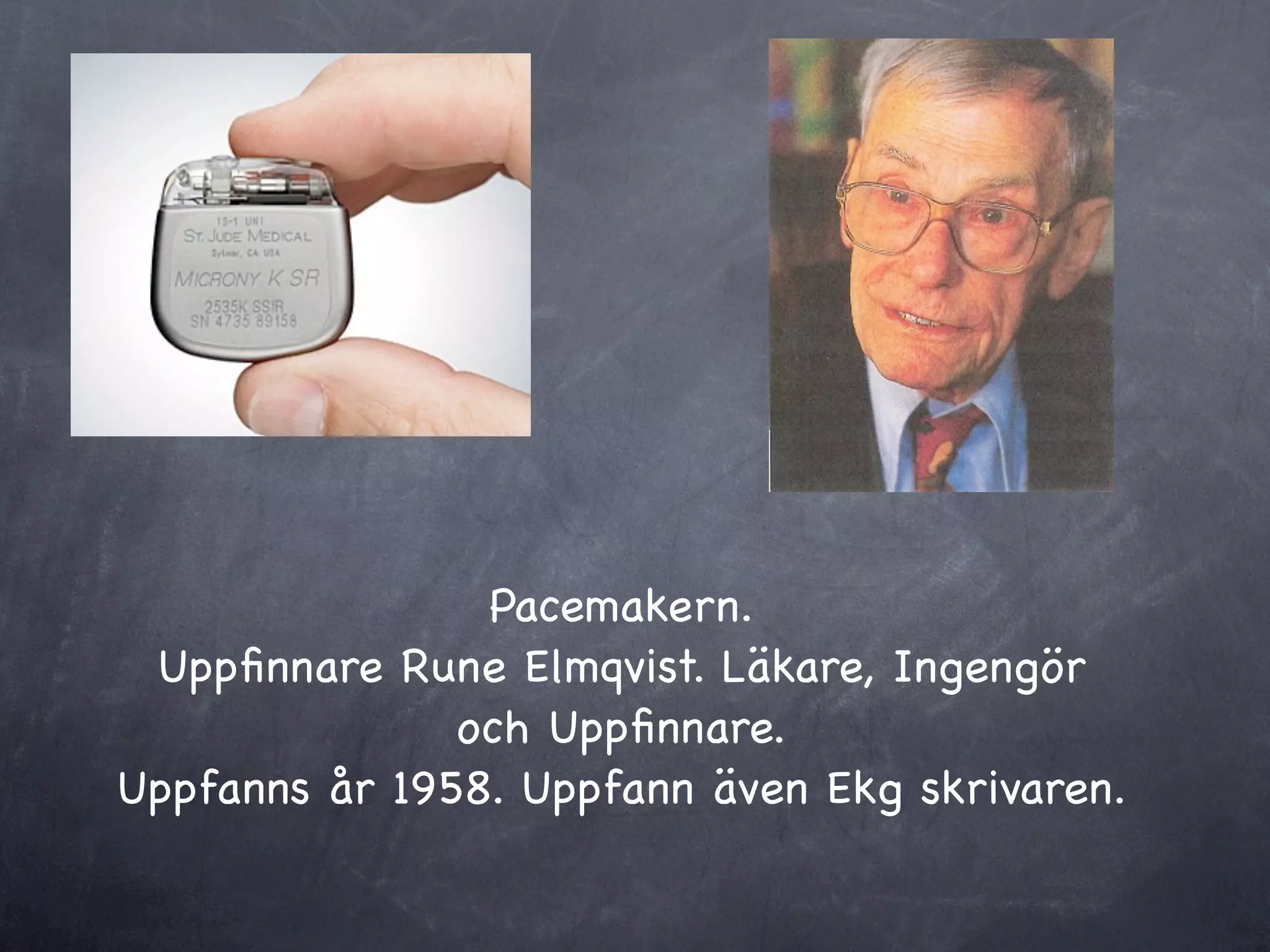 Pacemaker presentation | PPT