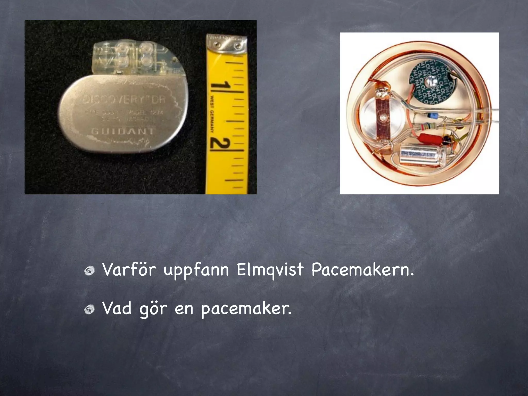 Pacemaker presentation | PPT