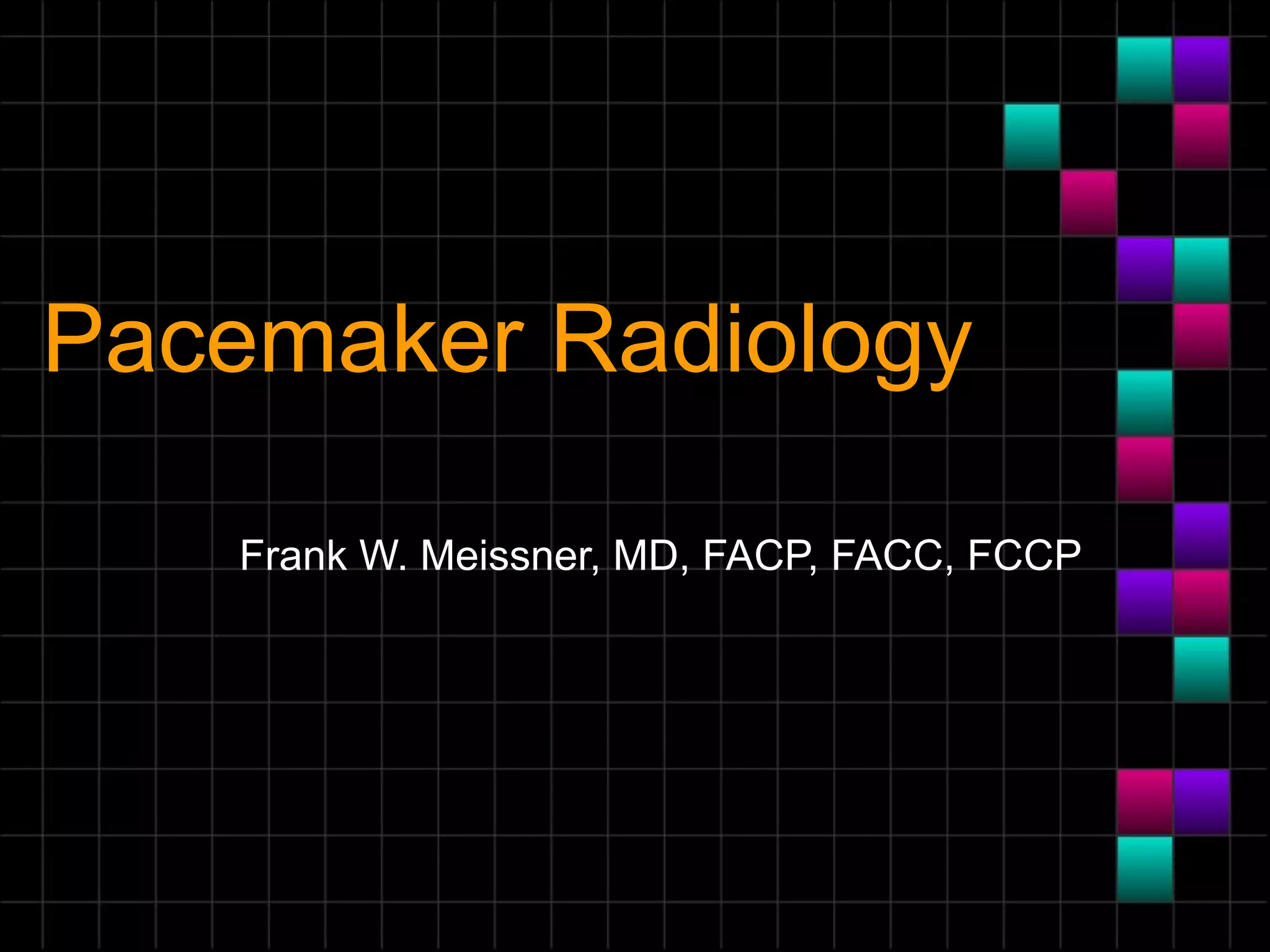 Pacemaker radiologyanintroduction | PPT