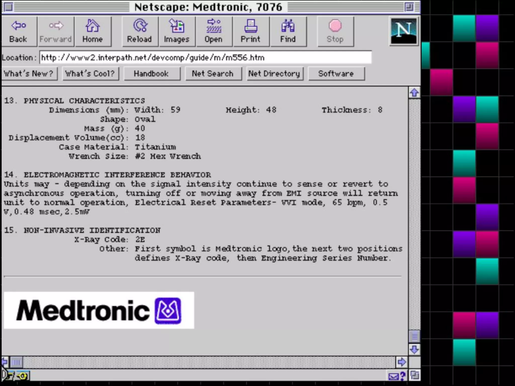 Pacemaker radiologyanintroduction | PPT