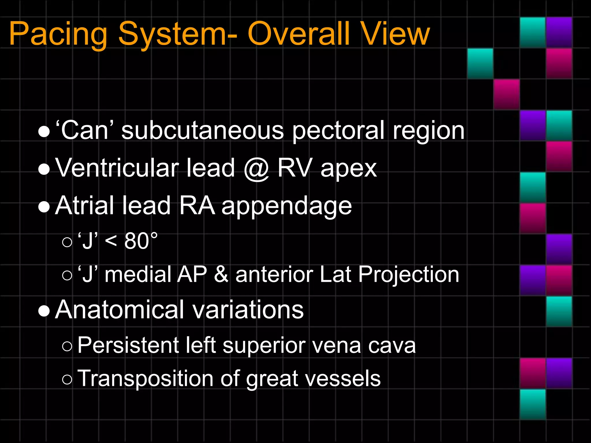 Pacemaker radiologyanintroduction | PPT