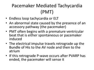 Pacemakers | PPT