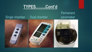 Pacemakers | PPTX