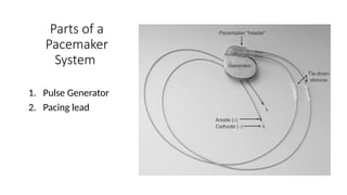 General Overview of Modern Cardiac Pacemakers | PPTX
